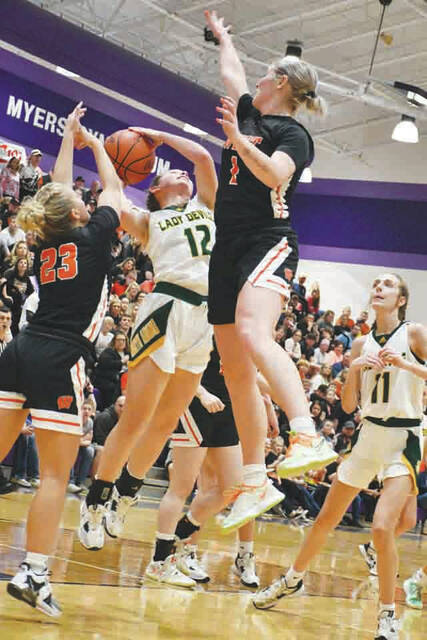 That first loss comes at a bad time | People's Defender